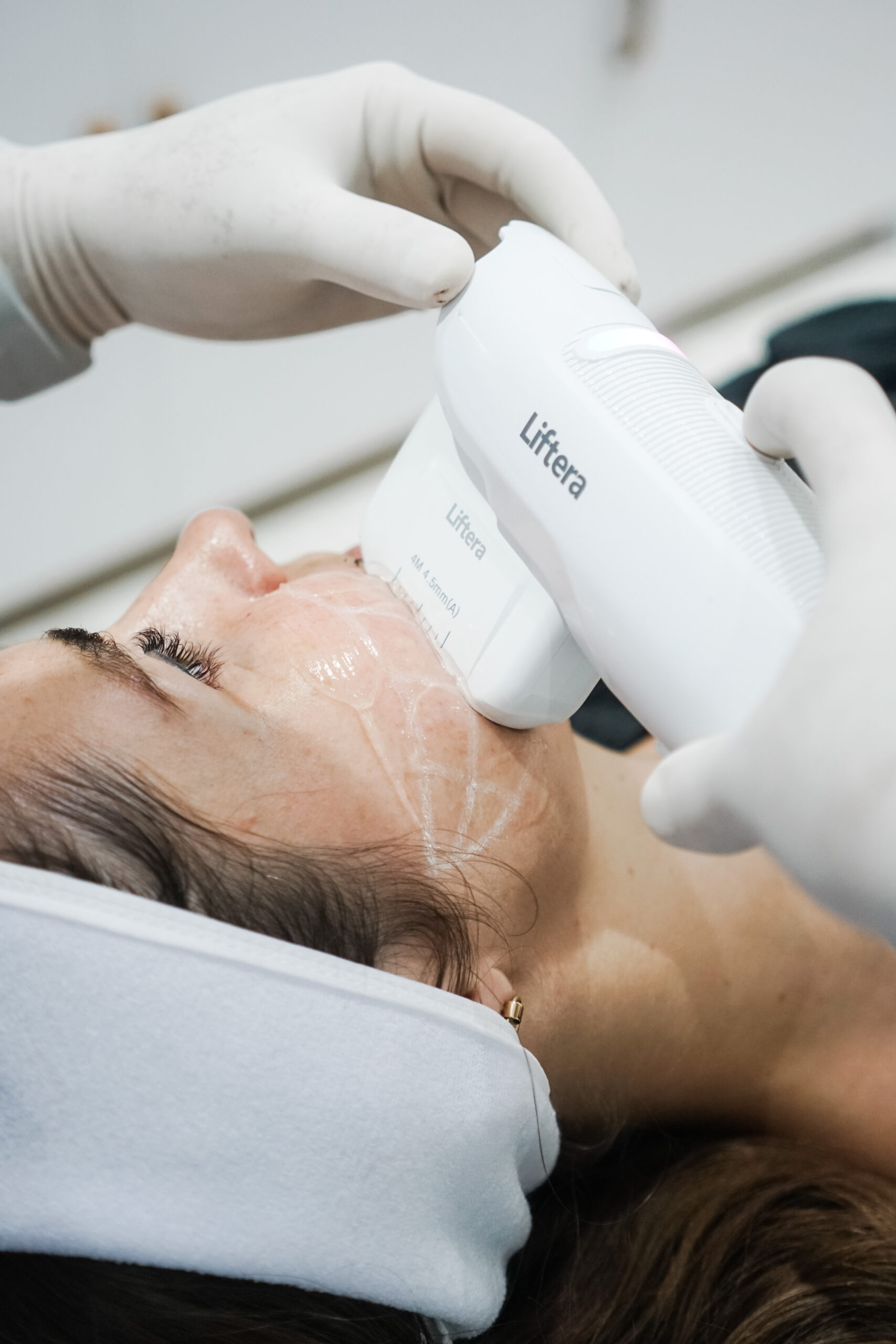 Injectable Rejuvenation Treatments – Body Lab Bali