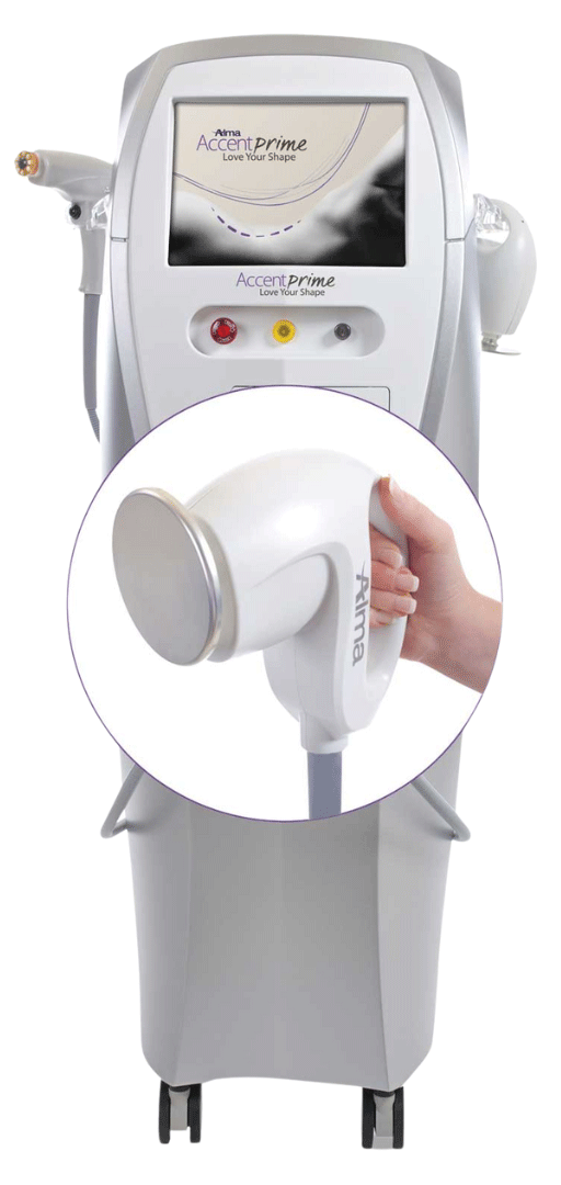 Alma Accent Prime Slimming – Body Lab Bali